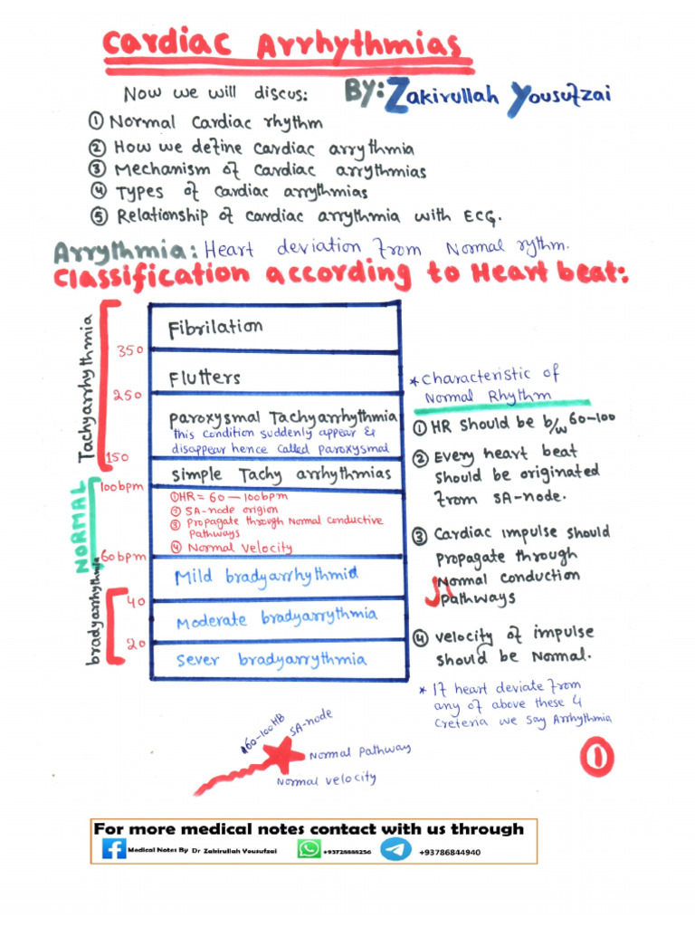 9 Cardiac Arrhythmias | PDF
