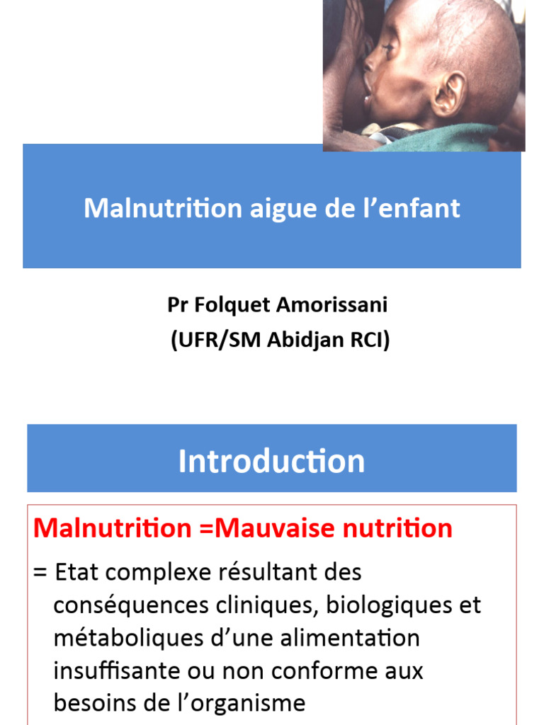 Malnutrition Aigue de L'enfant | PDF | Malnutrition | Nutrition
