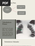 Gambaran Radiologi Tuberkulosis Paru | PDF