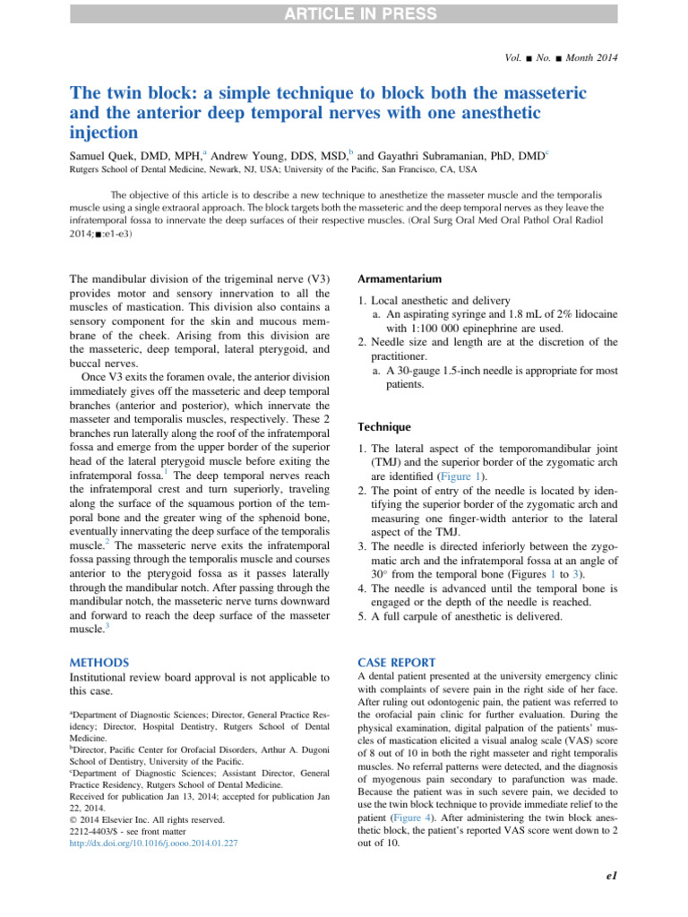 The Twin Block - A Simple Technique To Block Both The Masseteric and The Anterior Deep Temporal ...