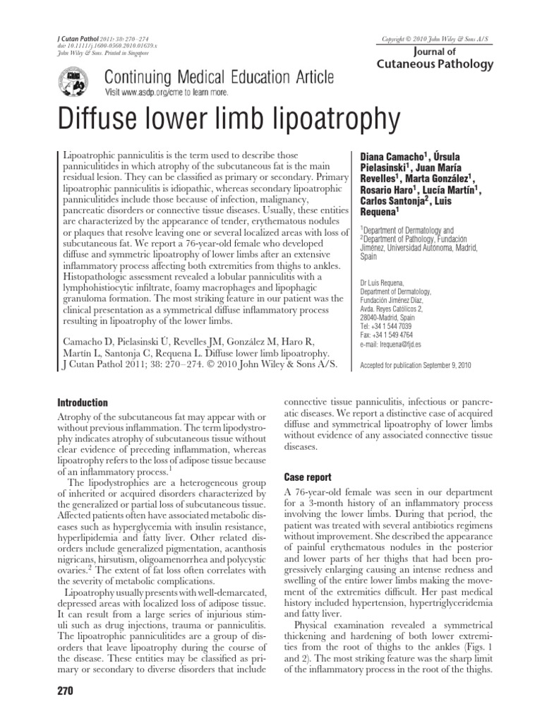 Lipoatrophy | PDF | Inflammation | Causes Of Death