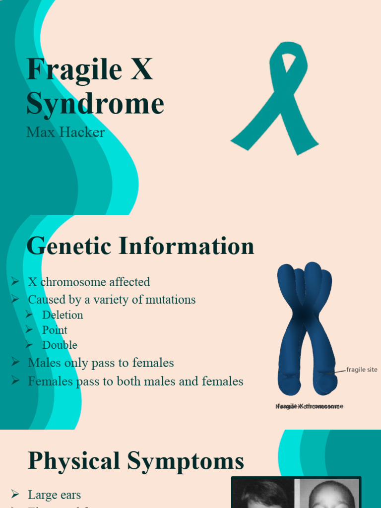 Understanding Fragile X Syndrome | PDF