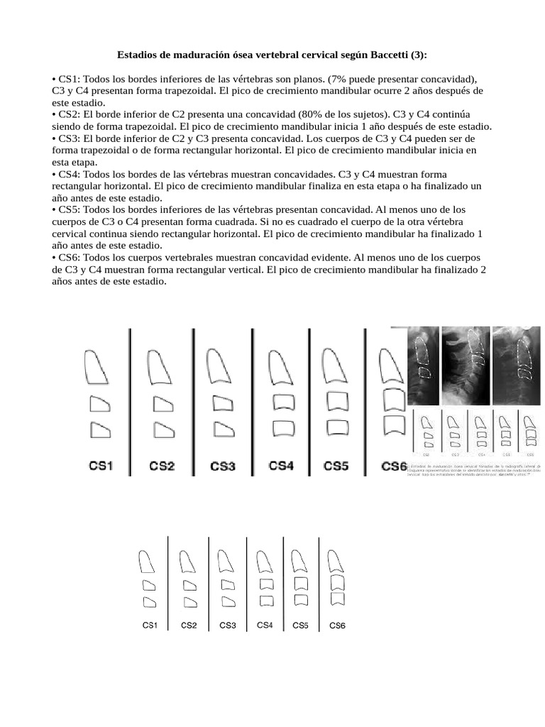Maduracion Vertebras Cervicales Baccetti | PDF | Métodos y materiales ...
