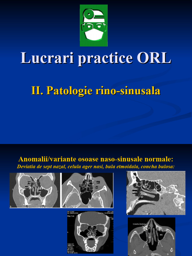 Lucrari Practice ORL II Patologie Rino-Sinusala | PDF | Spécialités médicales | Maladies et troubles