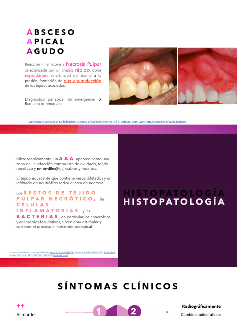Tratamiento de Absceso Apical Agudo | PDF | Inflamación | Ciencias de ...
