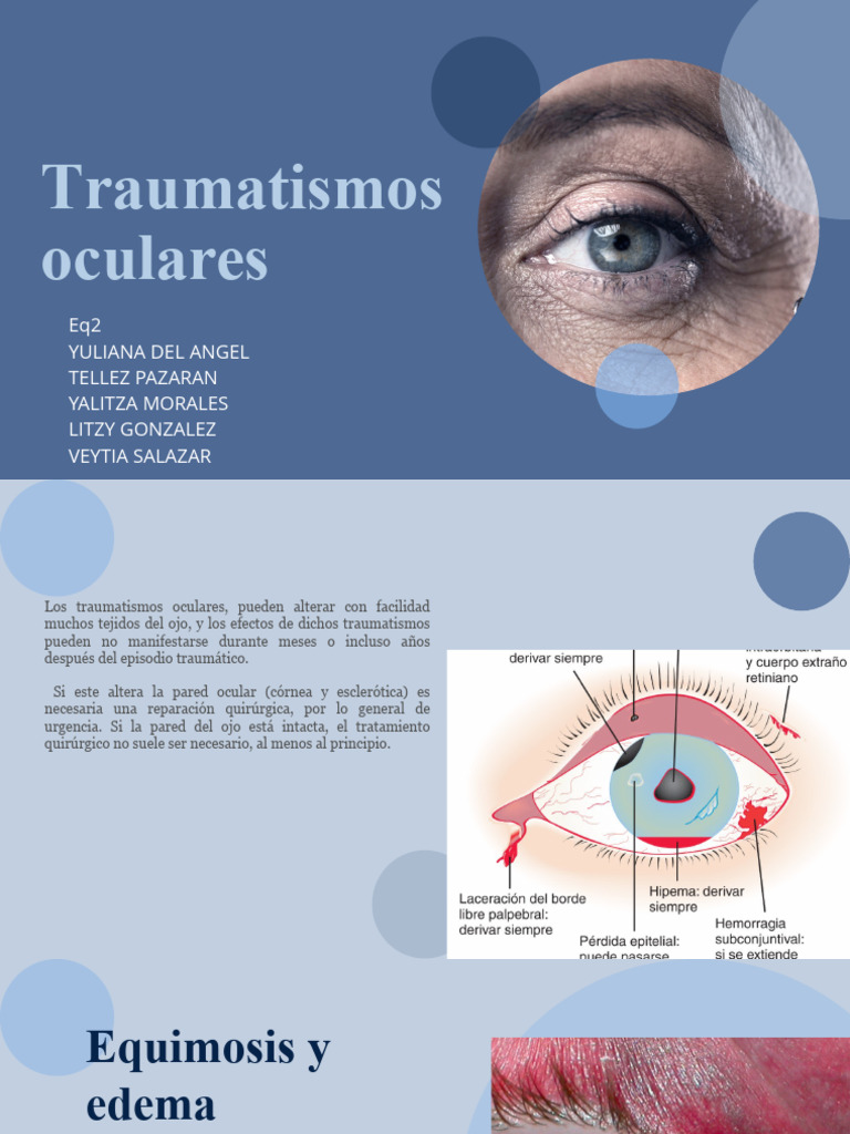 Trauma Ocular Eq2 | PDF | Ojo humano | Oftalmología