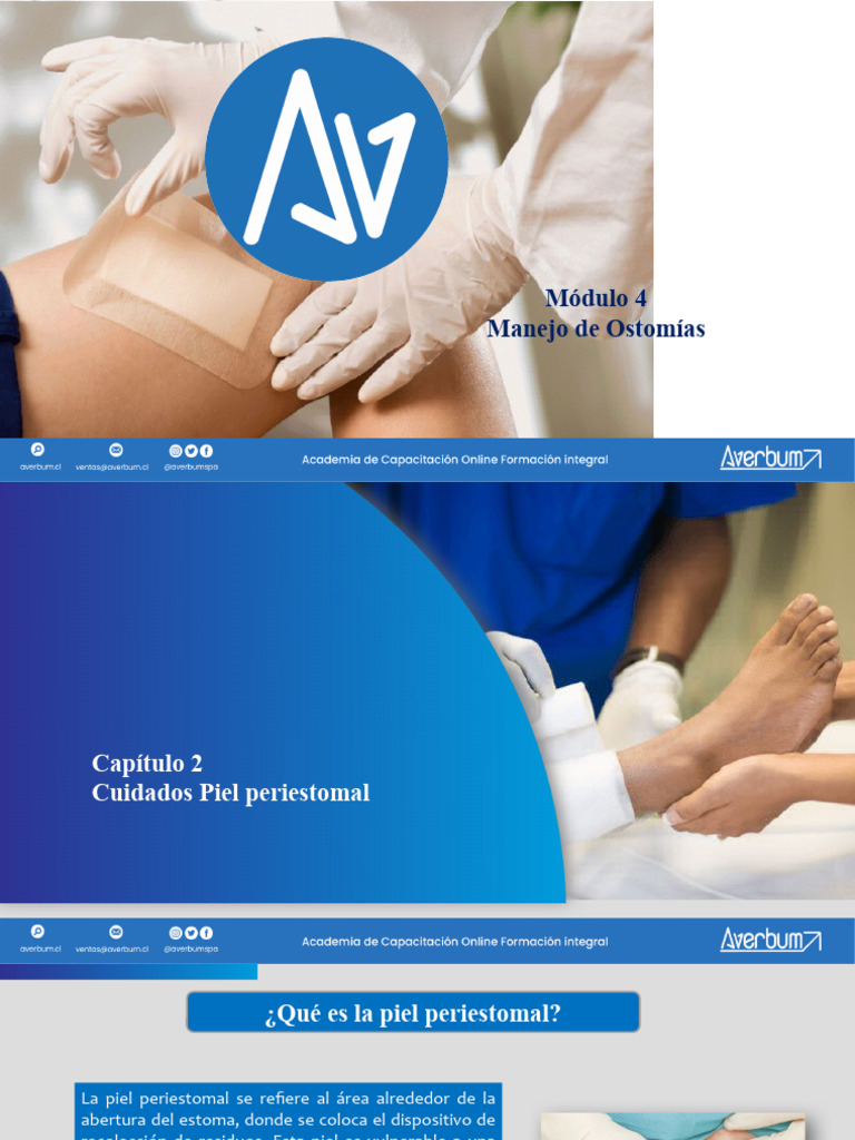 MODULO 4 CAPITULO 1 GENERALIDADES OSTOMIAS | PDF