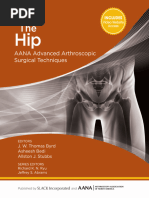 Posterior Tibial Tendon Insufficiency (PTTI) - Foot & Ankle ...