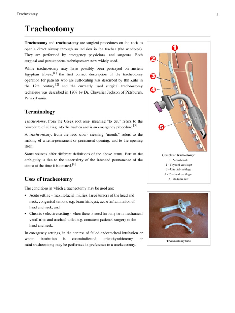 Tracheotomy | PDF | Medicine | Human Anatomy