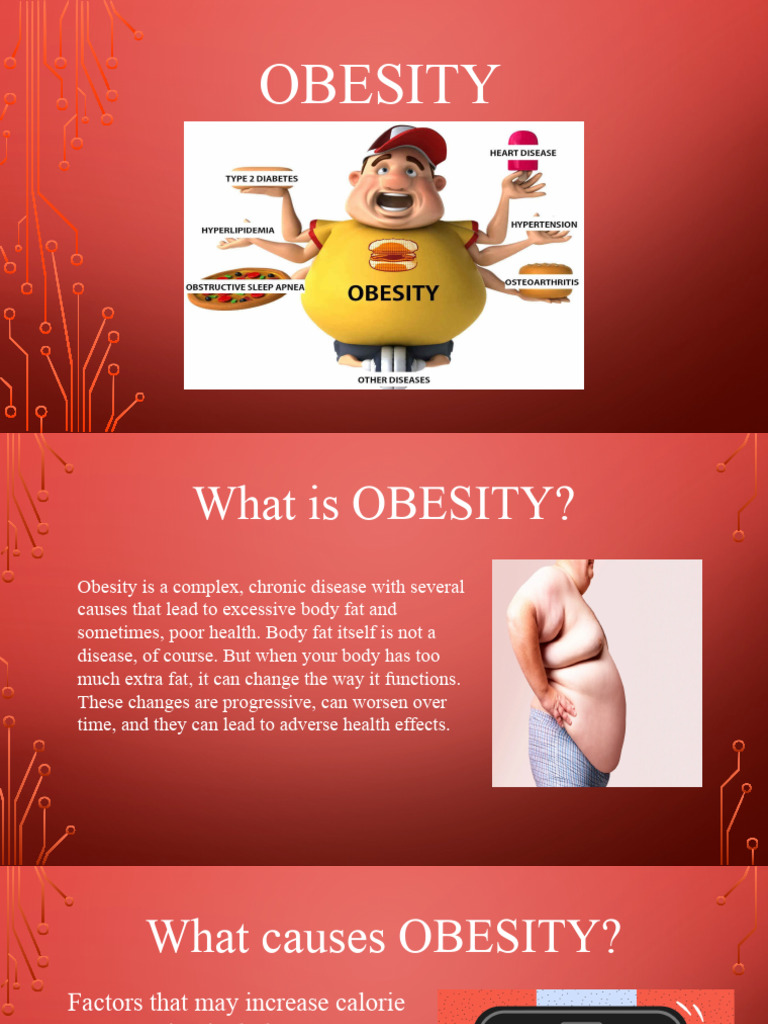OBESITY | PDF | Obesity | Fat