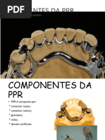 Componentes da Prótese Parcial Removível | PDF