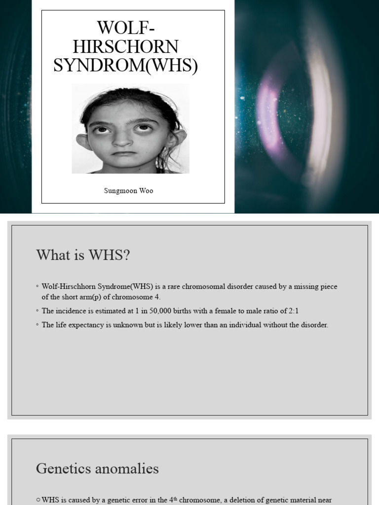 Wolf Hirschhorn Syndrom (WHS) | PDF | Medicine | Medical Specialties