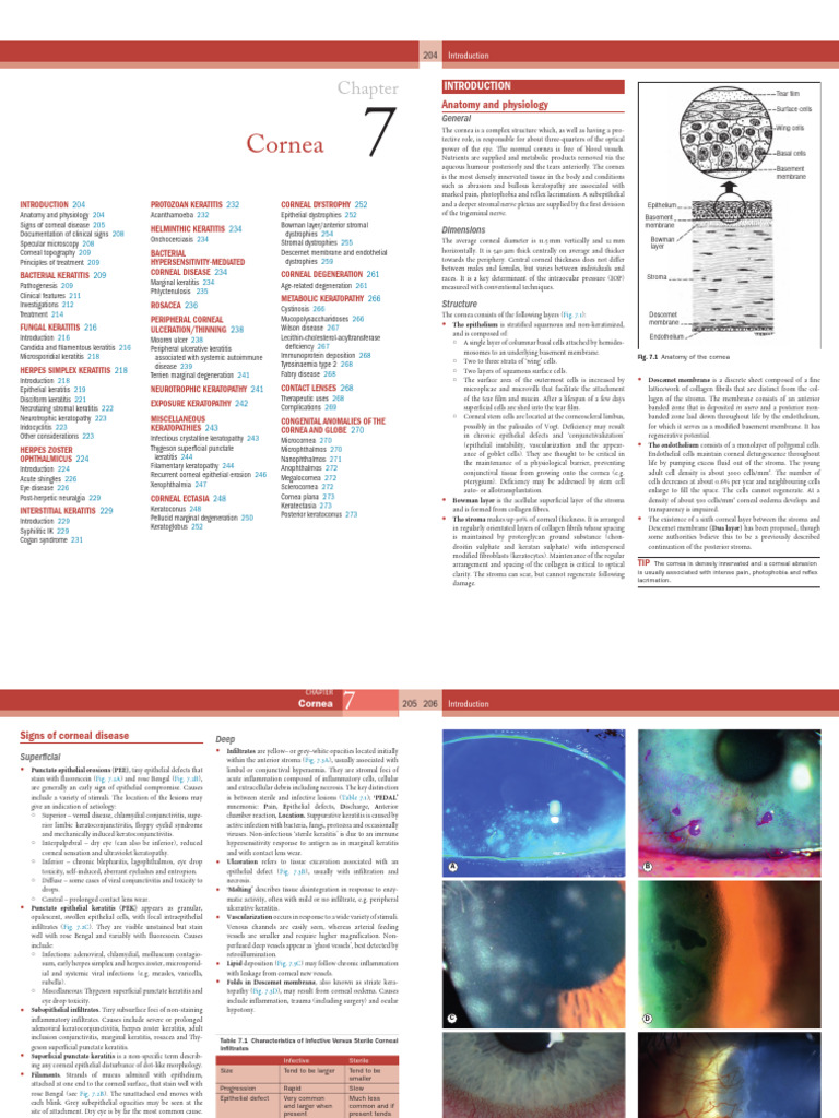 Overview of Corneal Diseases and Treatments | PDF | Cornea | Contact Lens