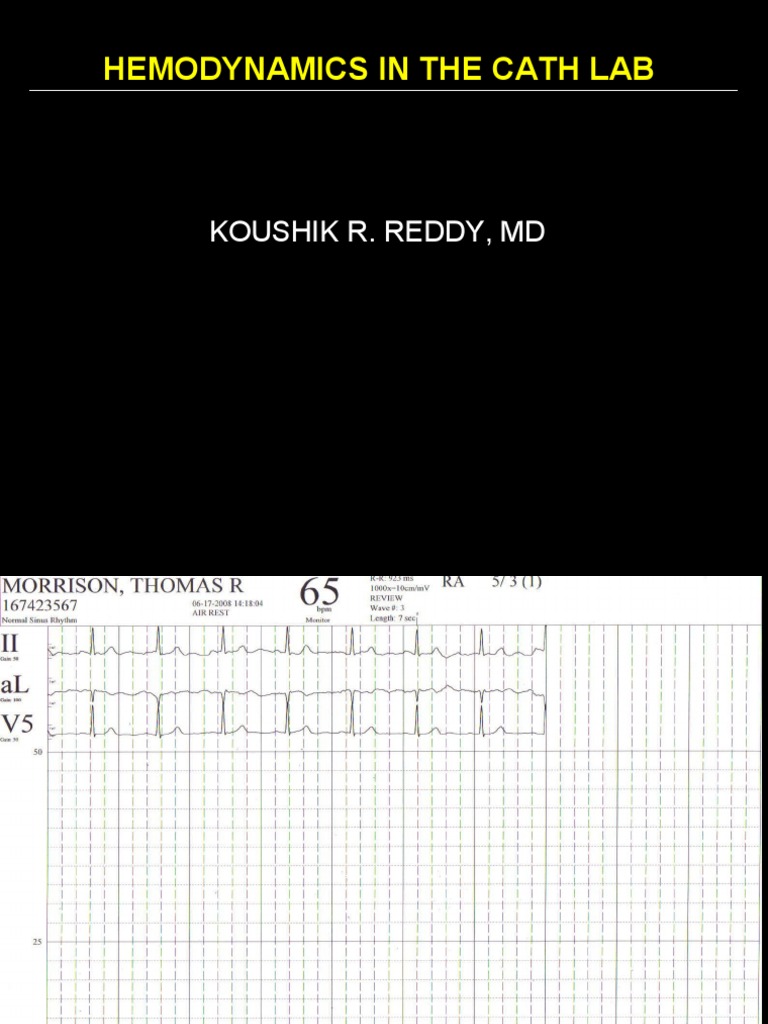Hemodynamics in the Cath Lab 2 | Amplitude | Frequency