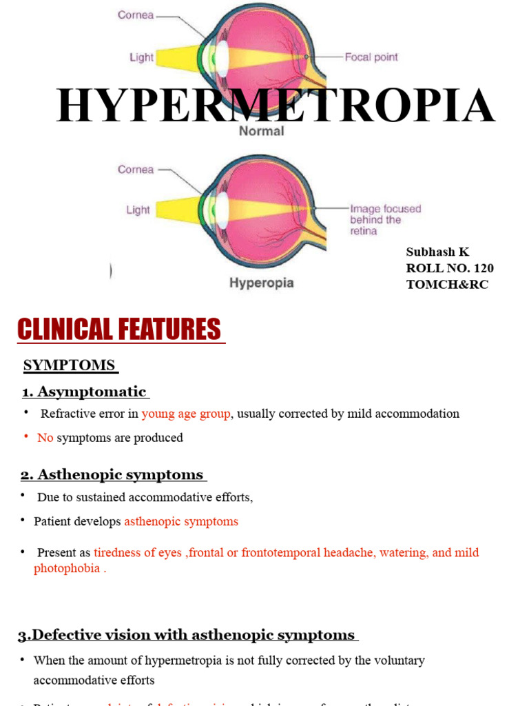 Subhash 120 Hypermetropia | PDF | Vision | Human Eye