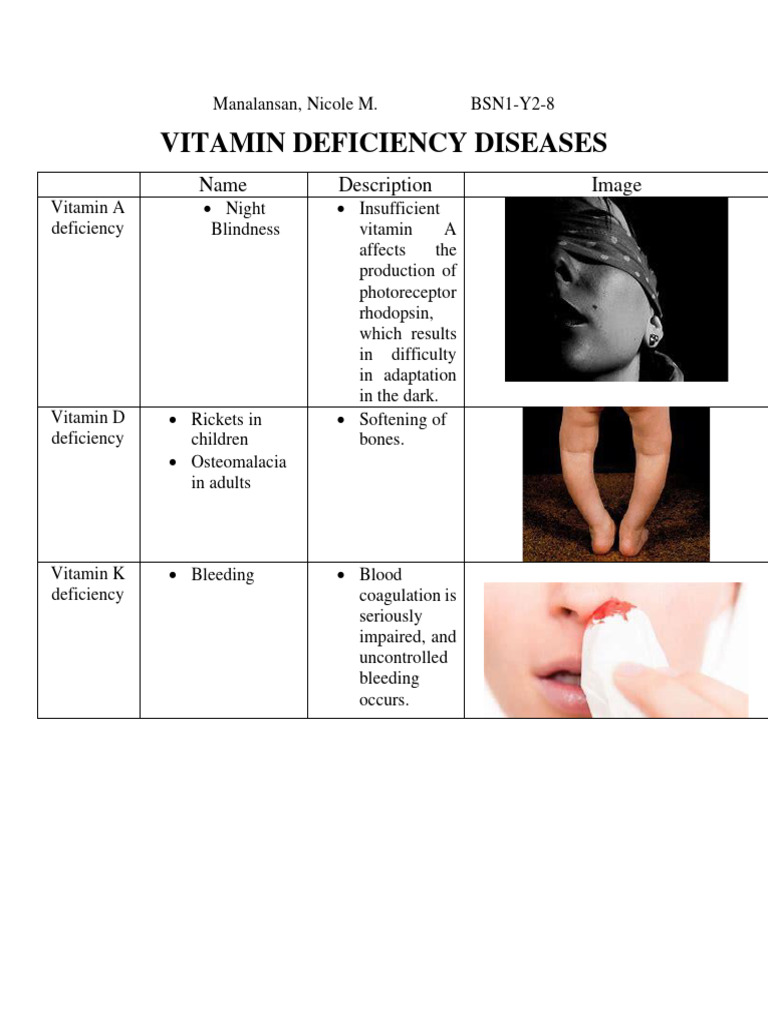 Vitamin Deficiency | PDF | Vitamin | Diseases And Disorders