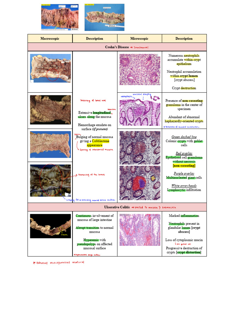 Abnormal Intestines | PDF | Gastrointestinal Tract | Epithelium