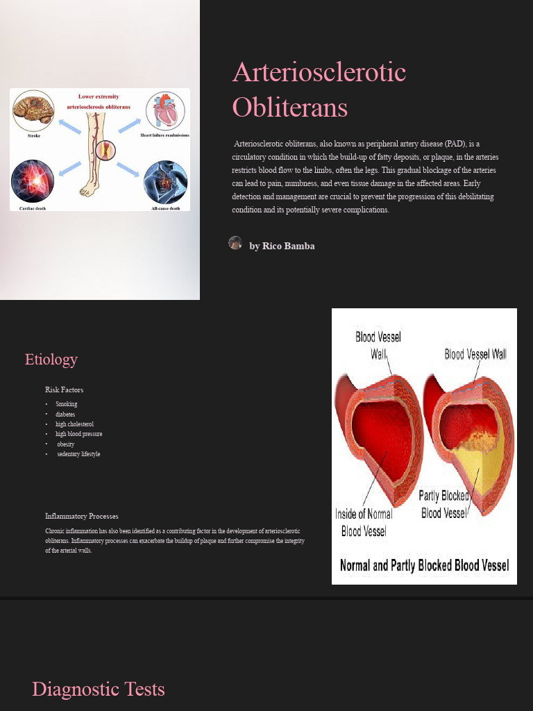 Understanding Arteriosclerotic Obliterans | PDF | Atherosclerosis ...