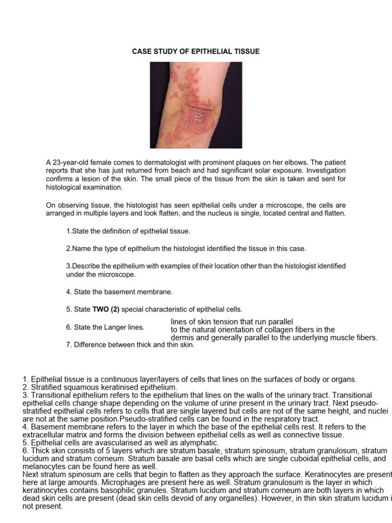Epithelial Tissue Case Study Analysis | PDF | Epithelium | Skin