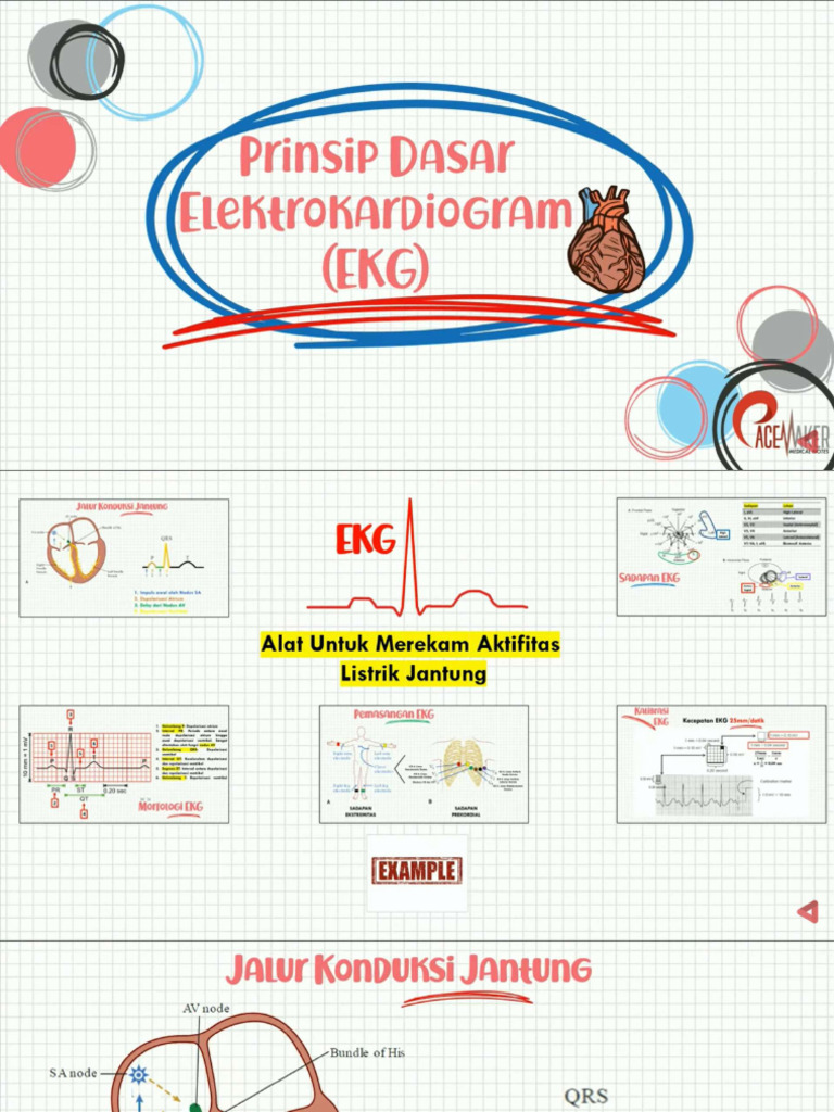 Belajar EKG | PDF