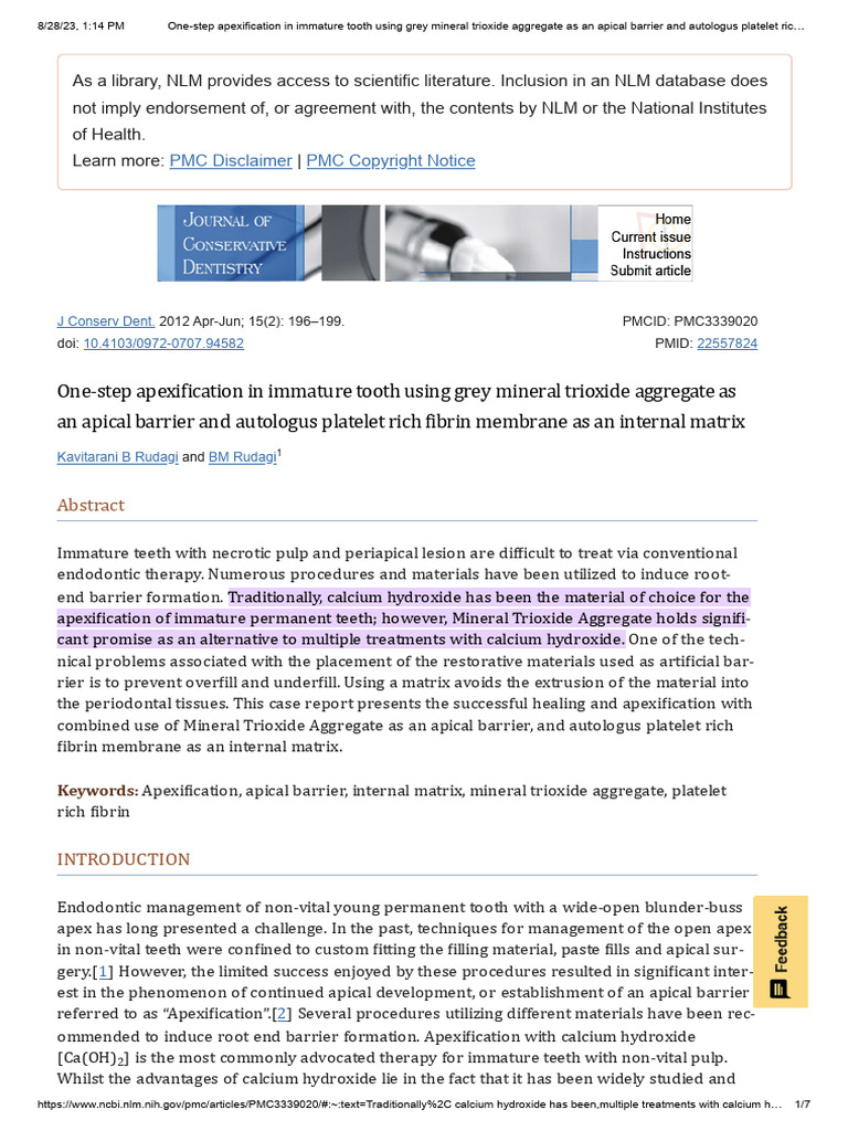 One-Step Apexification in Immature Tooth Using Grey Mineral Trioxide ...