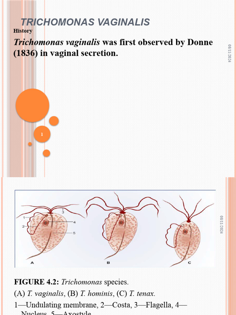 Trichomonas Vaginalis 9 | PDF | Sexually Transmitted Infection | Infection