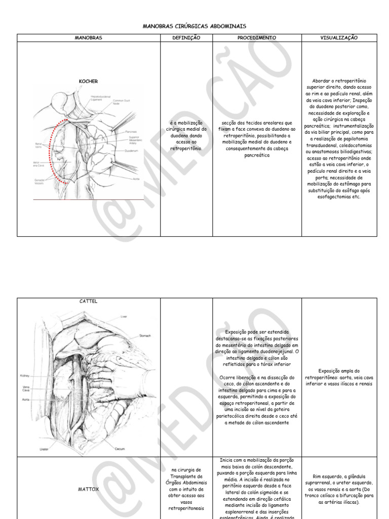Manobras Cirúrgicas no Retroperitônio | PDF | Rim | Intestino delgado