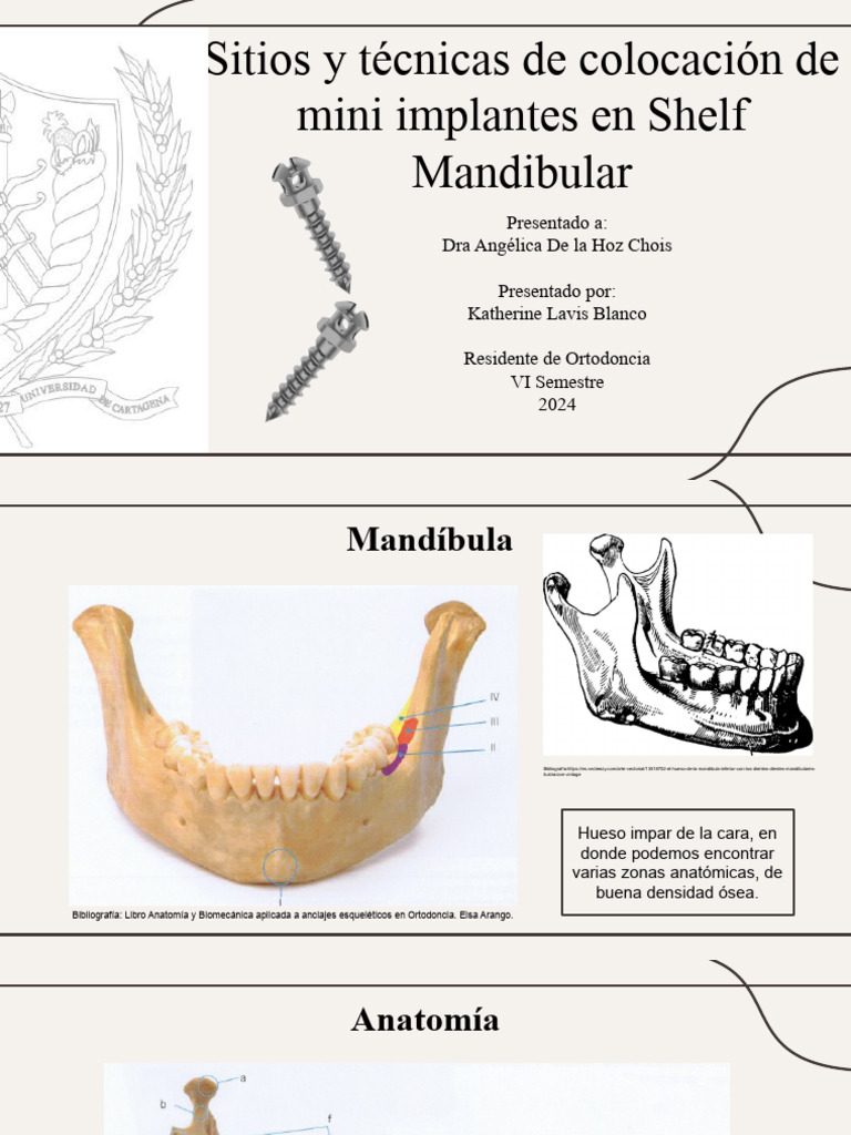 Mini Implantes En Shelf Mandibular Pdf Morfología Biología Anatomía