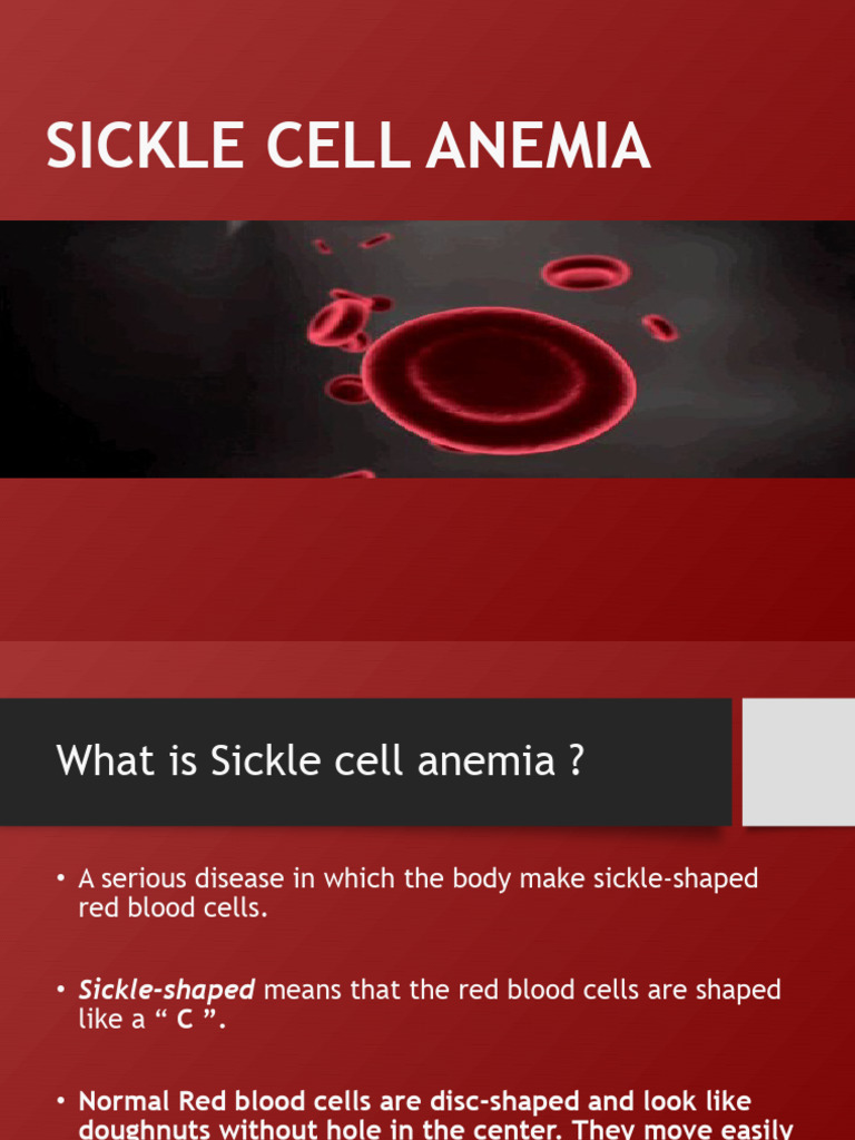 Sickle Cell Anemia | PDF | Anemia | Red Blood Cell