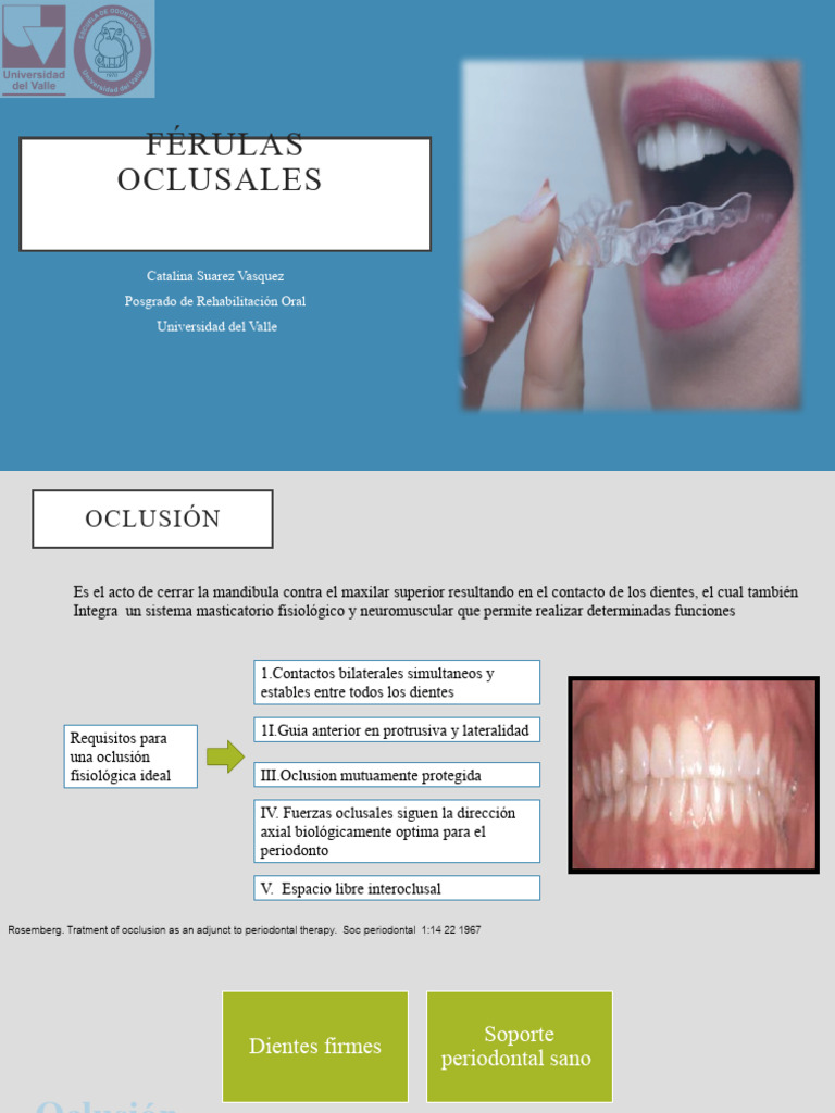 Férulas Oclusales: Tipos y Funciones | PDF | Odontología | Boca