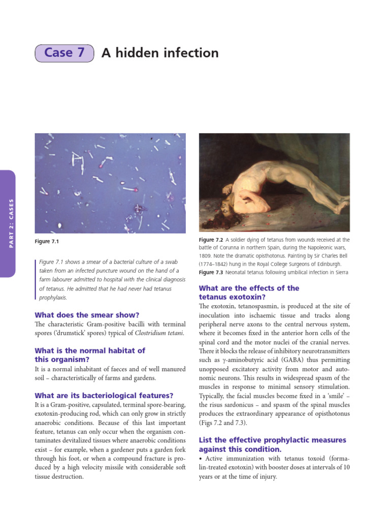 Tetanus Case | PDF | Neuroscience | Nervous System