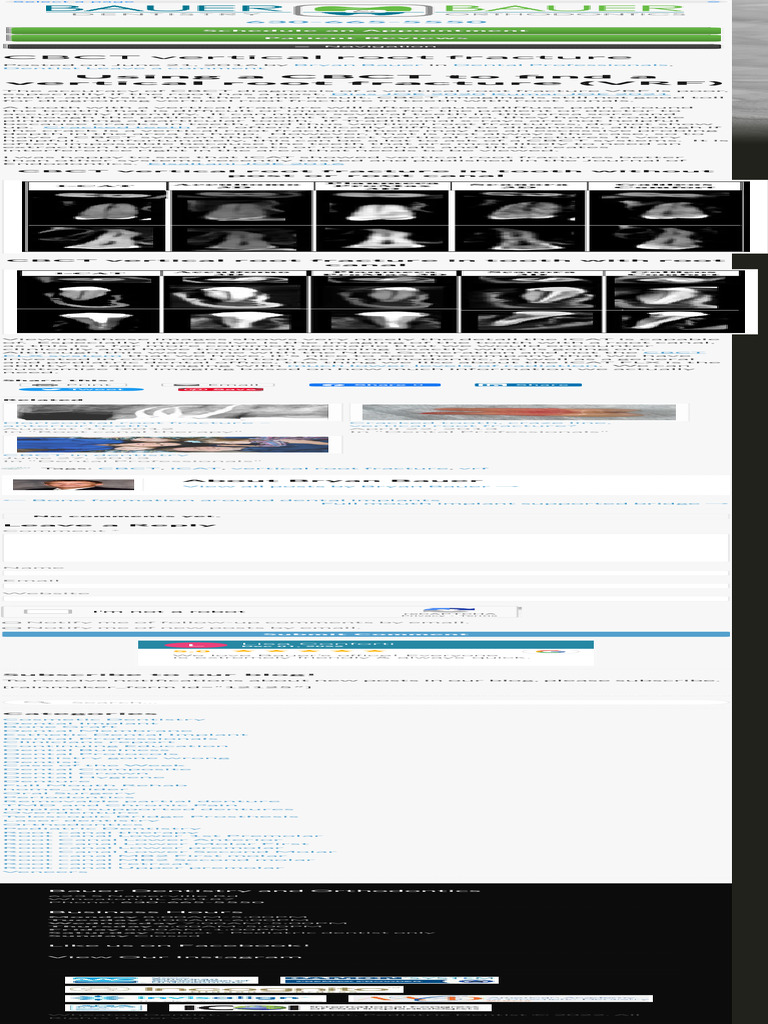 CBCT Vertical Root Fracture - Can It Be Done | PDF | Dentistry | Dentist