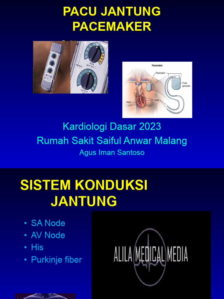 KD 2023 Pacemaker | PDF