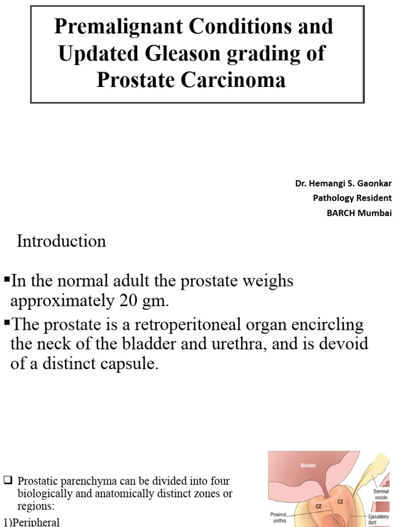 Premalinant Prostatic Lesions | PDF | Prostate | Prostate Specific Antigen