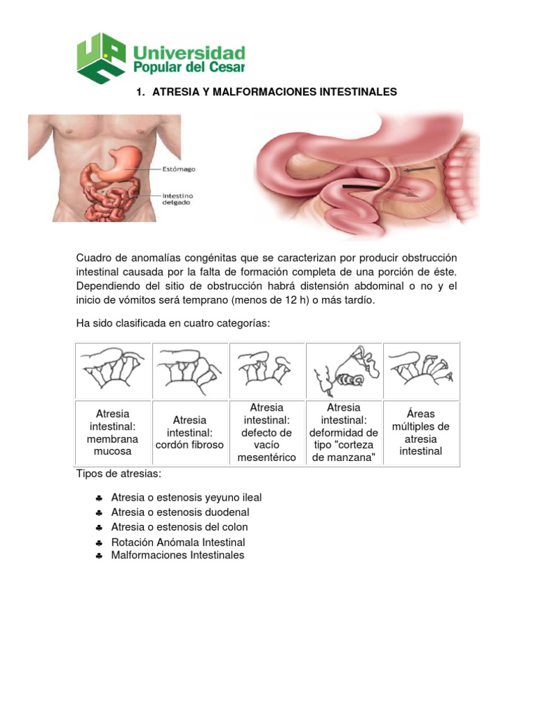 Atresia y Malformaciones Intestinales | PDF | Intestino grueso ...
