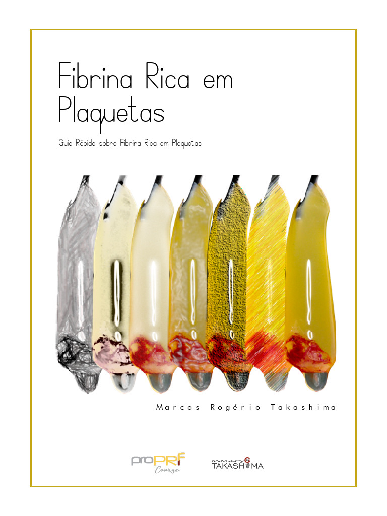 PRF - GUIA RÁPIDO Sobre Fibrina Rica em Plaquetas | PDF | Sangue ...