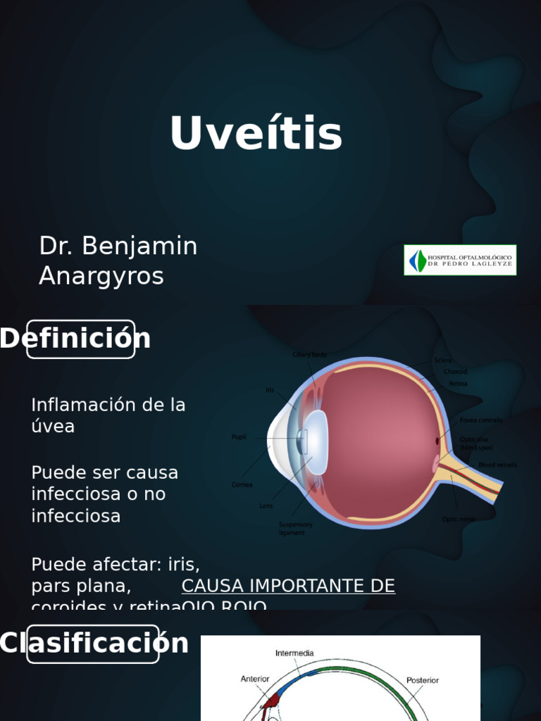 Uveítis: Tipos, Síntomas y Diagnóstico | PDF | Inflamación | Epidemiología