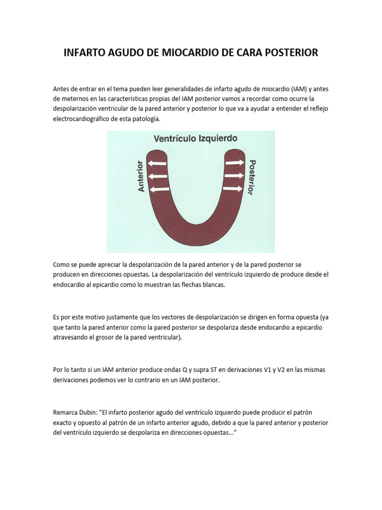 Infarto Agudo de Miocardio de Cara Posterior | PDF | Arte | Historia