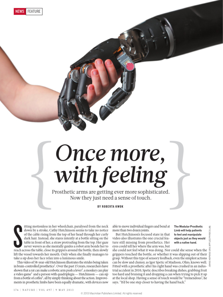 Prosthetic Arms Are Getting Ever More Sophisticated. Now They Just Need ...
