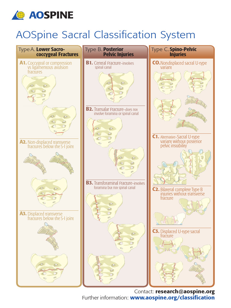 Aos Pcard100x150 Sacralcs Mar18 | PDF | Pelvis | Spinal Cord Injury