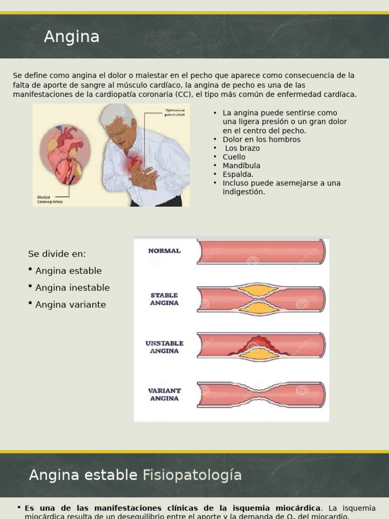 Anginas | PDF | Electrocardiografia | Fisiología