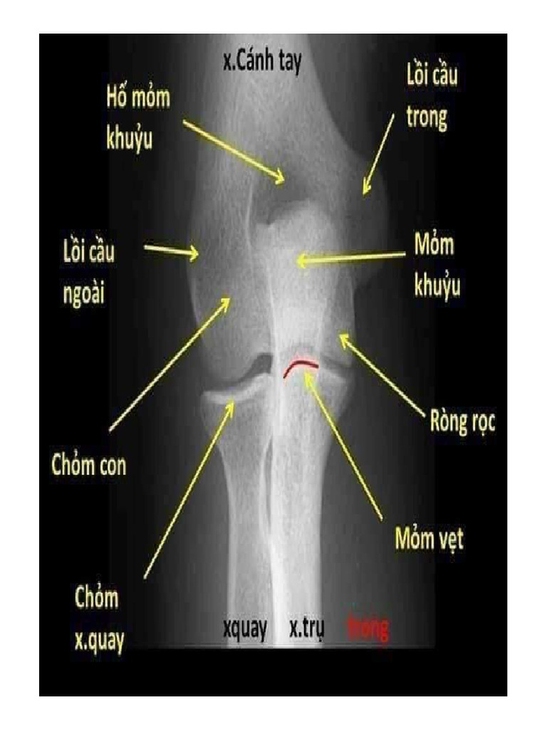 Đọc phim X-Quang | PDF