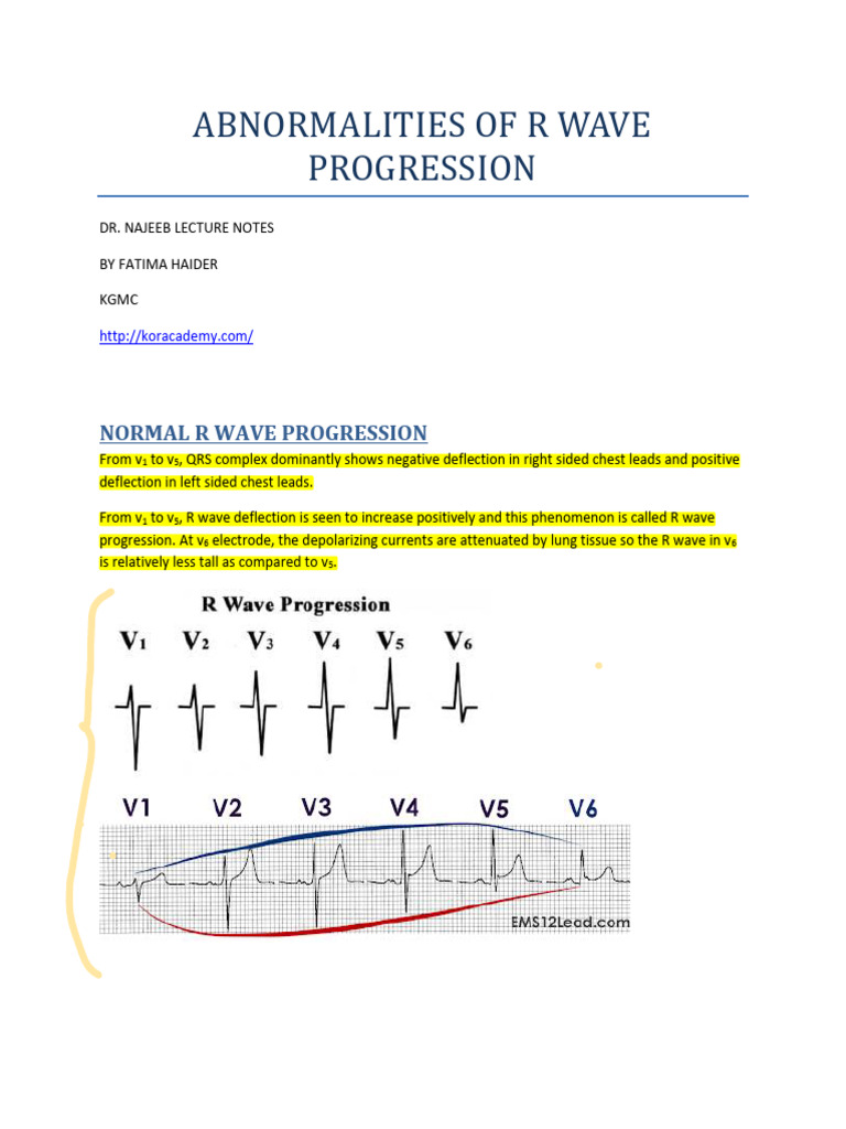 08 - Abnormalities of R Wave Progression - 0 | PDF | Cardiac ...