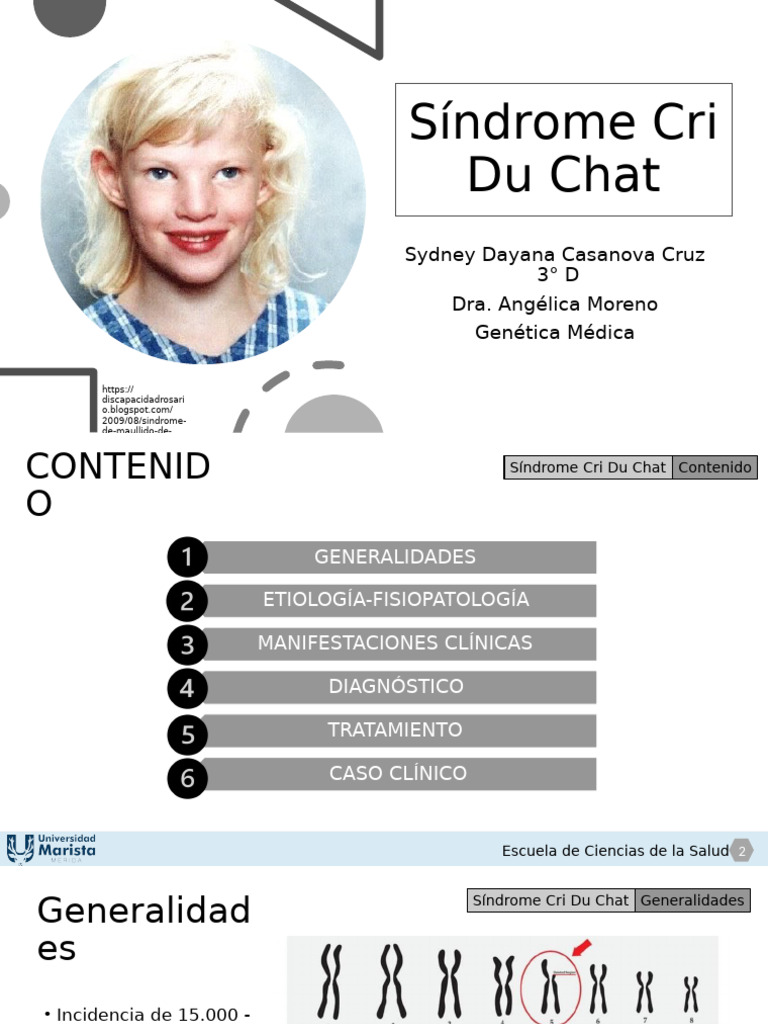 Expo - Síndrome Cri Du Chat | PDF | Biología | Enfermedades y trastornos
