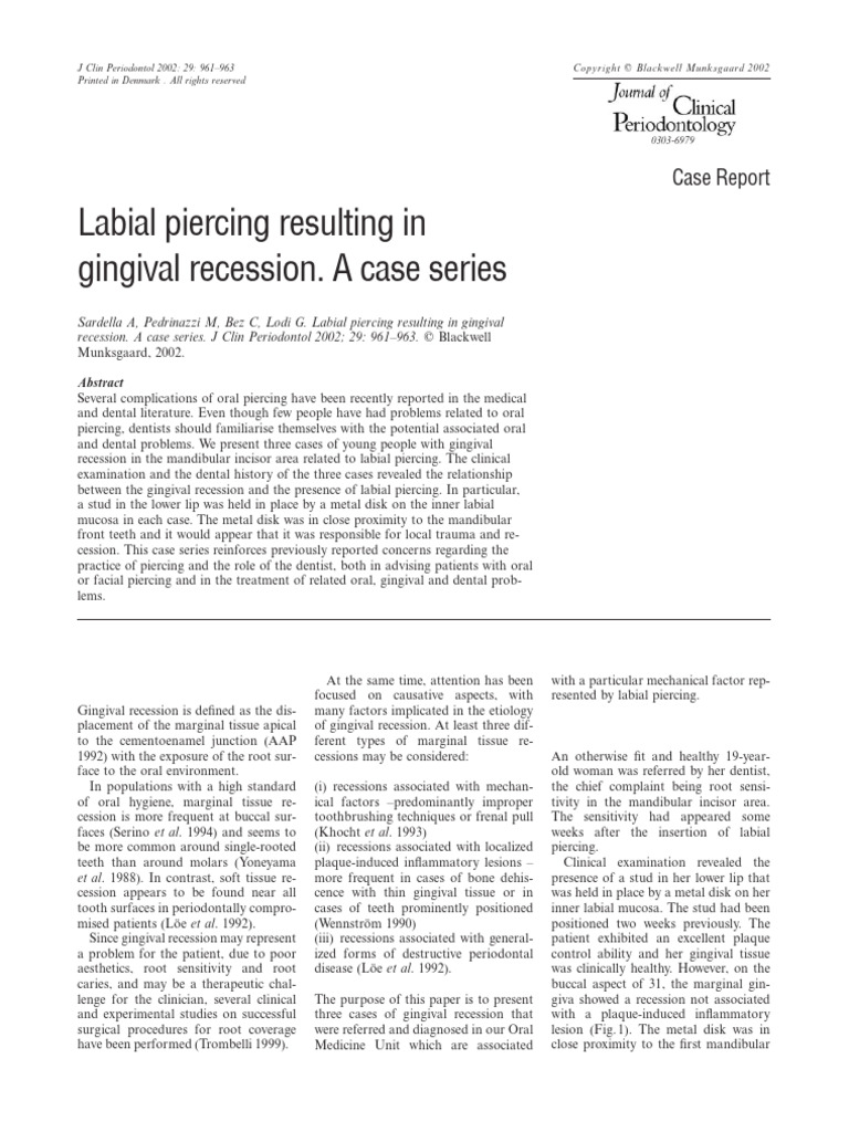 Sardella 2002 Recession and Piercing | PDF | Periodontology | Dentistry