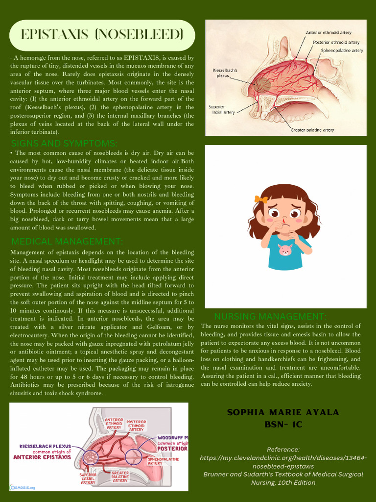 EPISTAXIS | PDF | Human Nose | Clinical Medicine