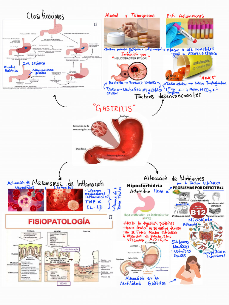Mapa Mental Gastritis - 240611 - 010209 | PDF