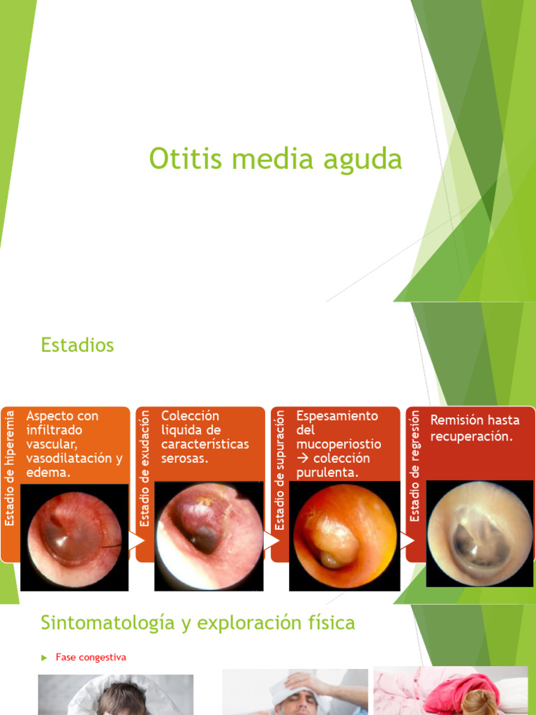 Otitis Media Aguda | PDF | Otorrinolaringología | Vértigo