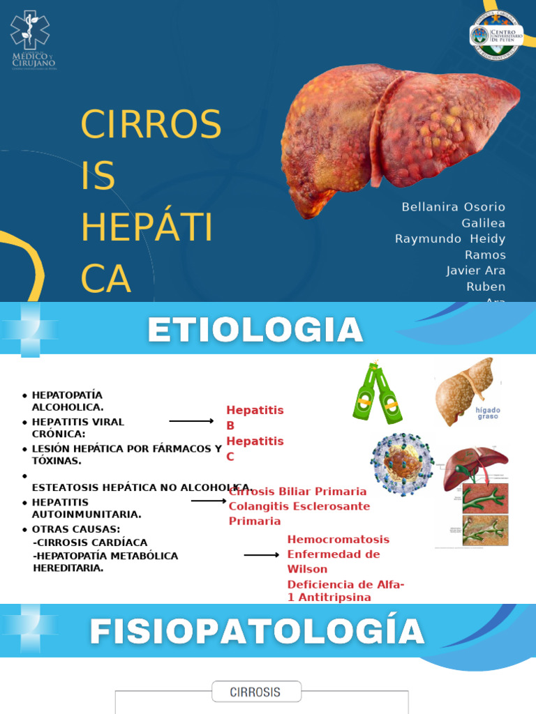 Cirro Sis | PDF | Cirrosis | Especialidades Medicas