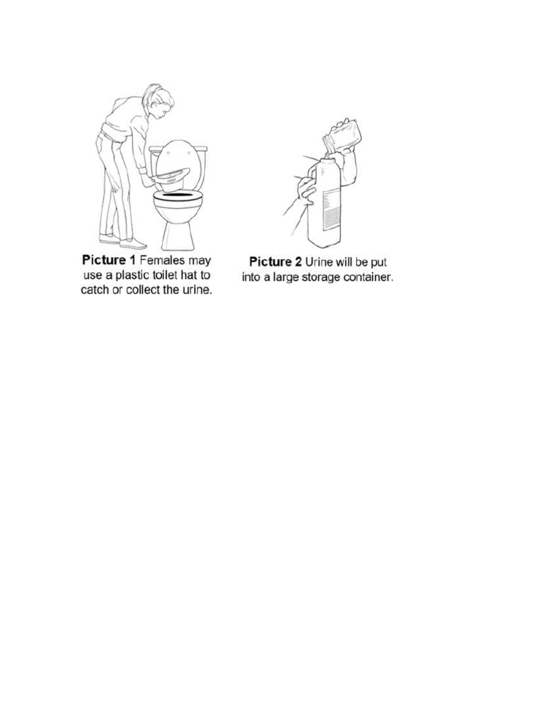 24 Urine Collection | PDF